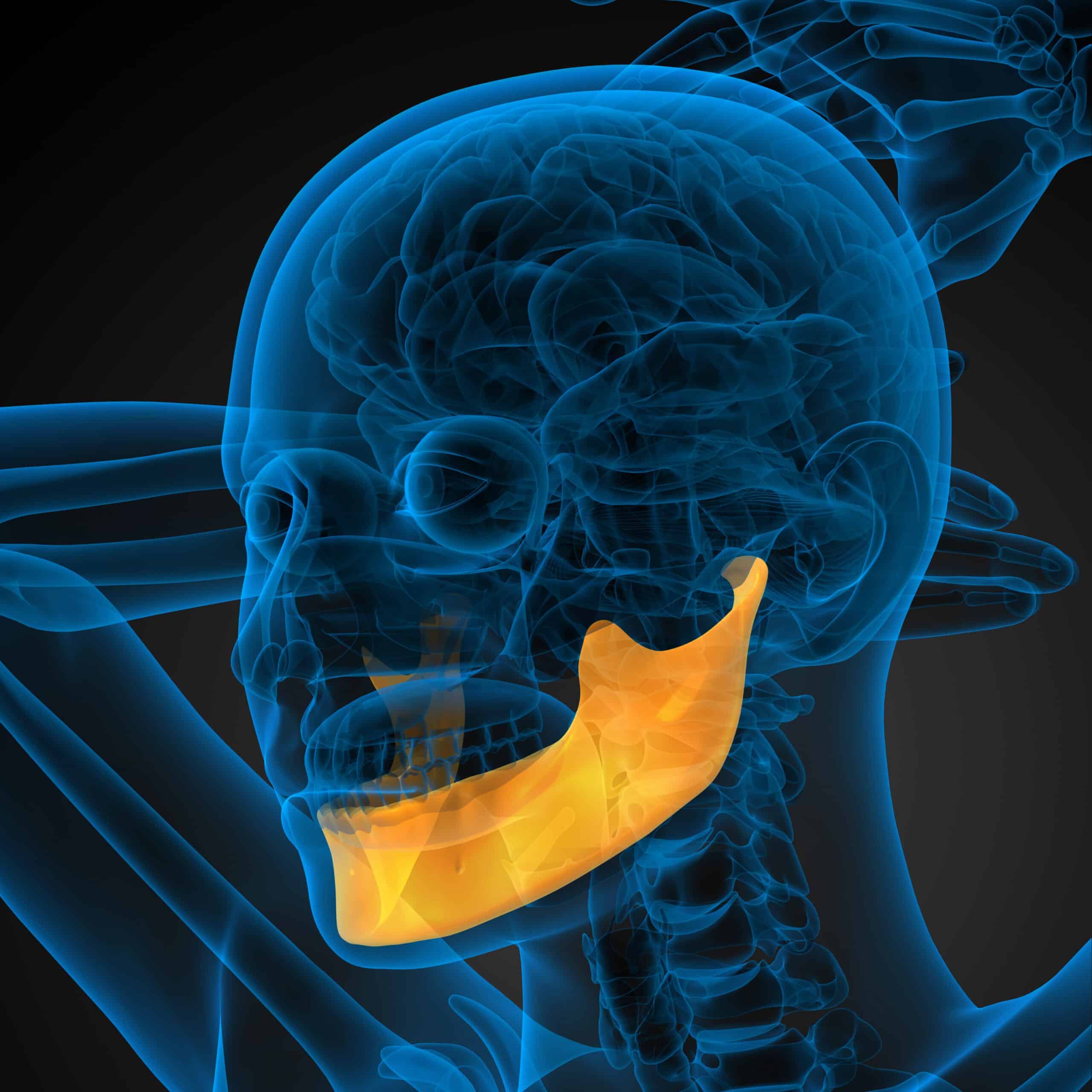 What You Need To Know About Jaw Bone Regeneration - integratedDENTAL