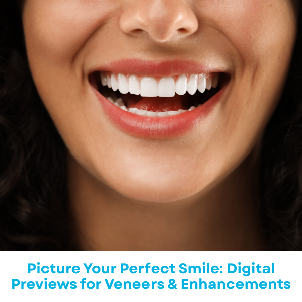 Picture Your Perfect Smile: Digital Previews for Veneers & Enhancements ...
